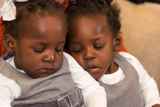 Once Joined at the Pelvic and Hip, Twins Walk into a New Life